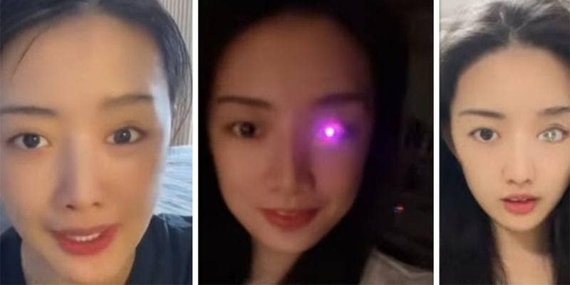 Xia Tong, la modella che ha perso un occhio in un incidente e da sola ...